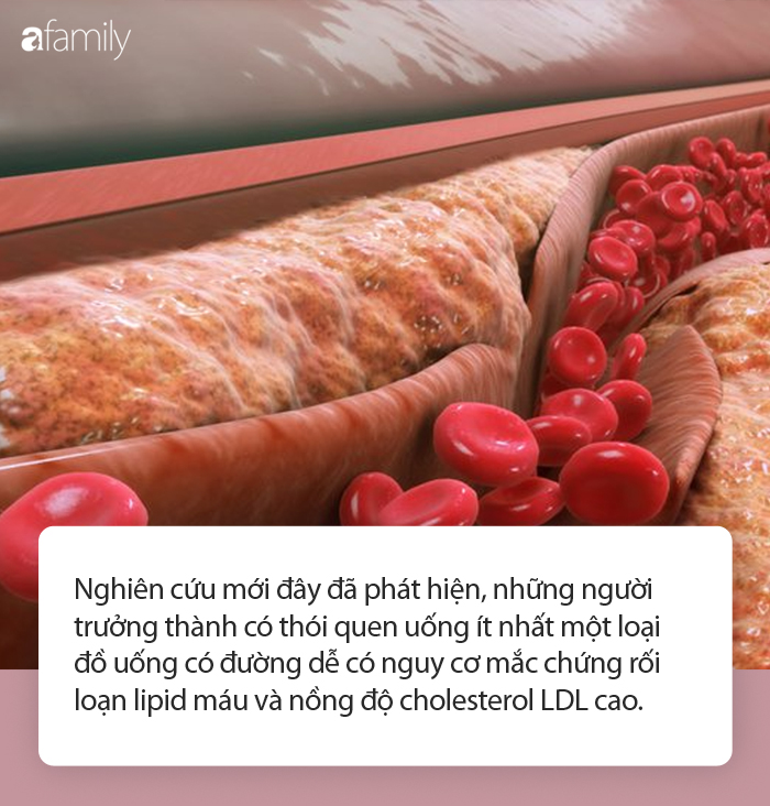 Đồ uống có đường ảnh hưởng thế nào tới sức khỏe tim và nồng độ cholesterol?