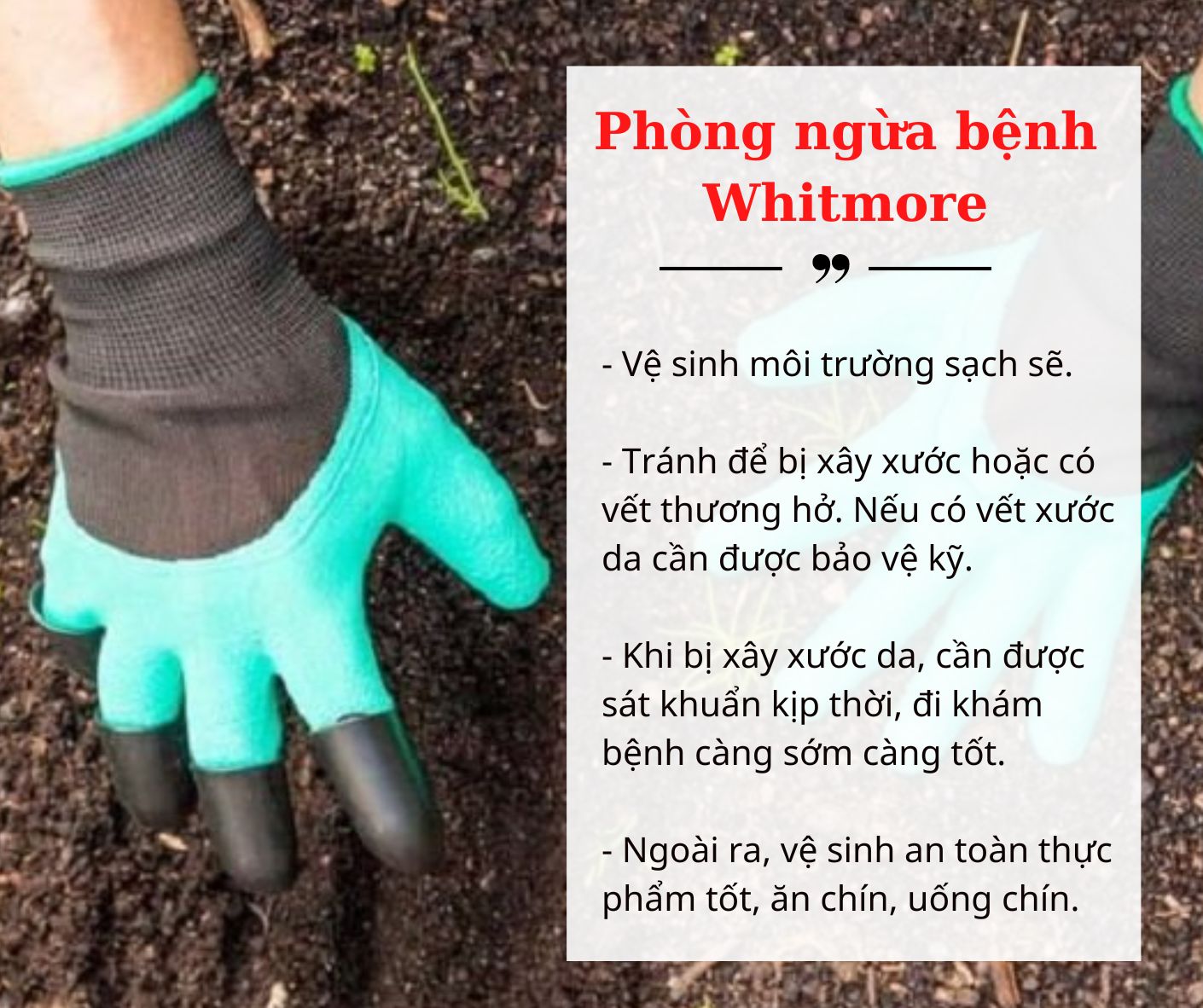 Bệnh Whitmore nguy hiểm như thế nào, có lây truyền không?