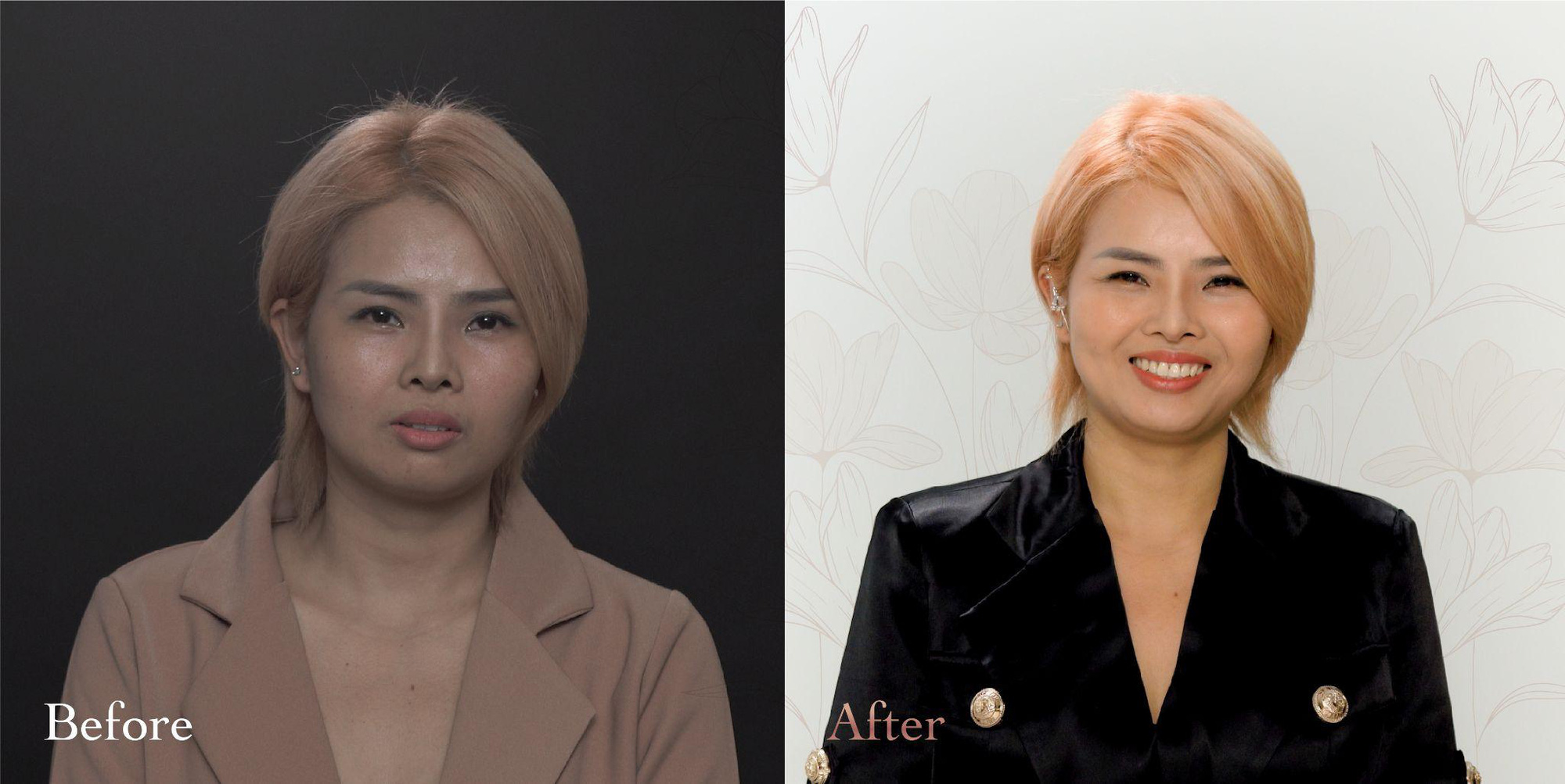 Lắng nghe và thấu hiểu làn da với chương trình "Dear CHLITINA"