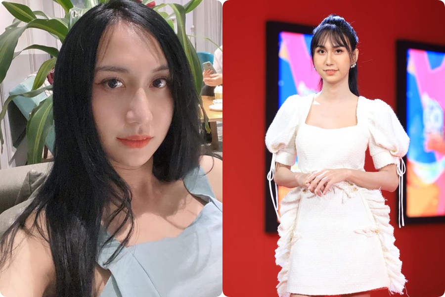 Nhan sắc của Lynk Lee 3 năm sau ngày công khai 8 lần phẫu thuật