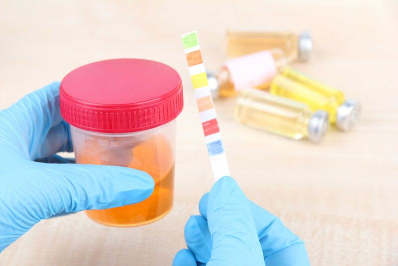 Nước tiểu đổi màu khi mang thai có nguy hiểm không?