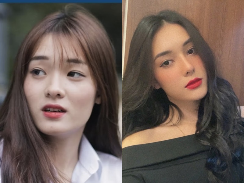 Á hậu Hồng Hạnh sửa mũi, nhấn mí, tiêm filler