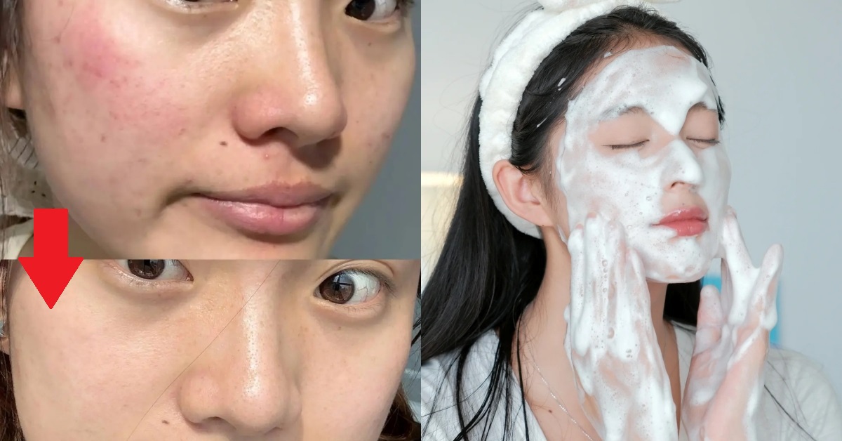 Thay đổi cách rửa mặt, làn da của tôi bất ngờ "đẹp lên trông thấy"