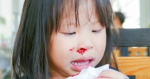 5 Bước Xử Trí Khi Trẻ Bị Chảy Máu Cam
