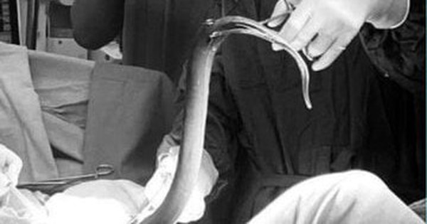 Nam thanh niên suýt mất mạng vì nhét con lươn vào hậu môn