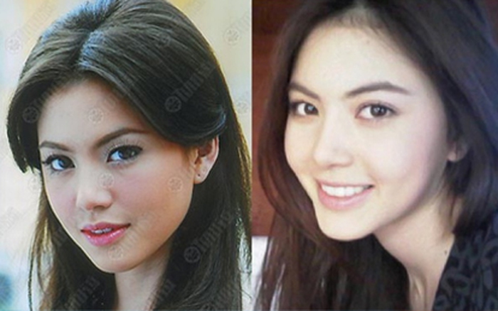Hoorne Davika Plastic Surgery